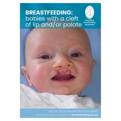 Breastfeeding babies with clefts of lip and/or palate | Australian ...
